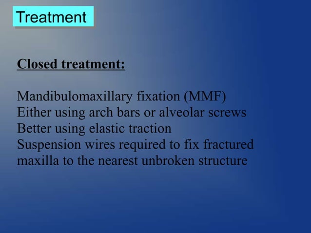 Mid face fracture-Maxillary fracture | PPT