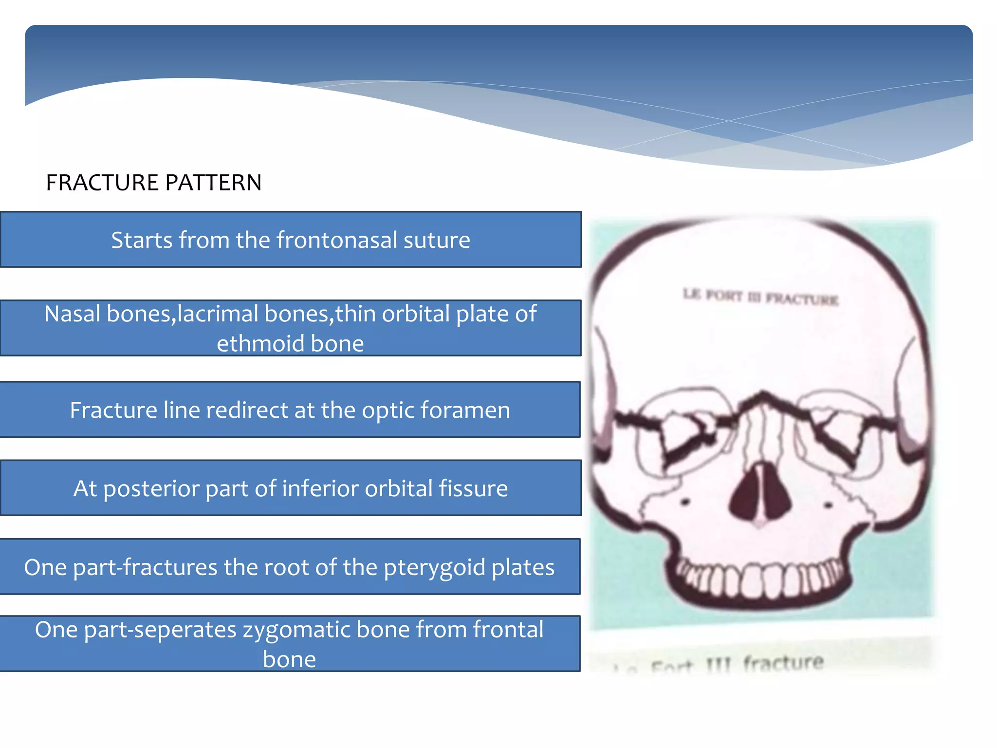 MAXILLARY FRACTURE.pptx