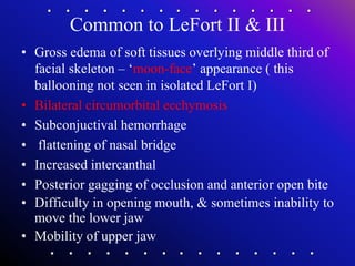 maxillary fractures.pptx