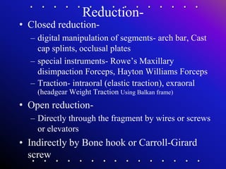 maxillary fractures.pptx