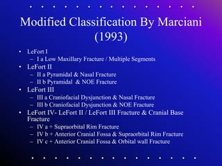 maxillary fractures.pptx