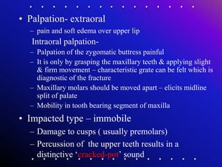 maxillary fractures.pptx