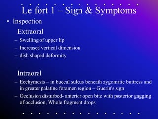maxillary fractures.pptx