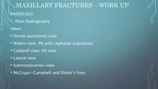 Maxillary fractures | PPTX