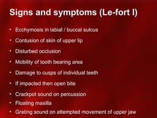Maxillary fractures ih | PPT