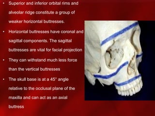 Maxillary fractures ih | PPT