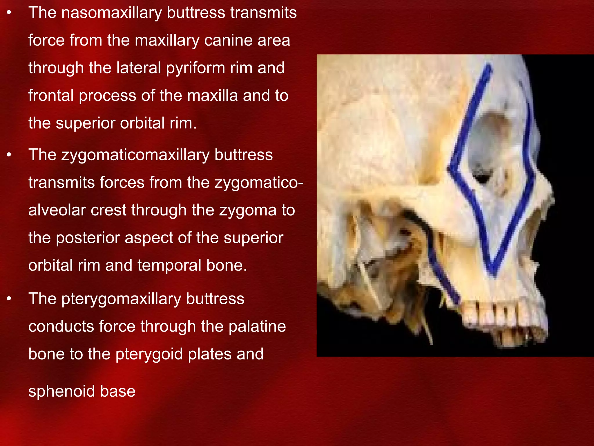 Maxillary fractures presentation ih | PPT