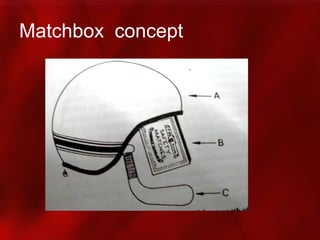 Maxillary fractures presentation ih | PPT