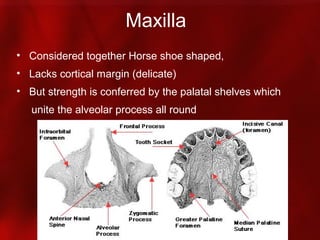 Maxillary fractures presentation ih | PPT