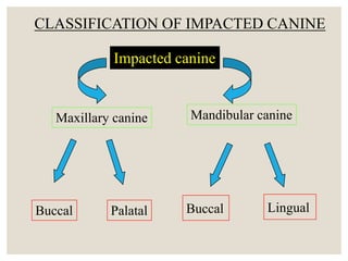 Maxillary impacted canine management | PPTX