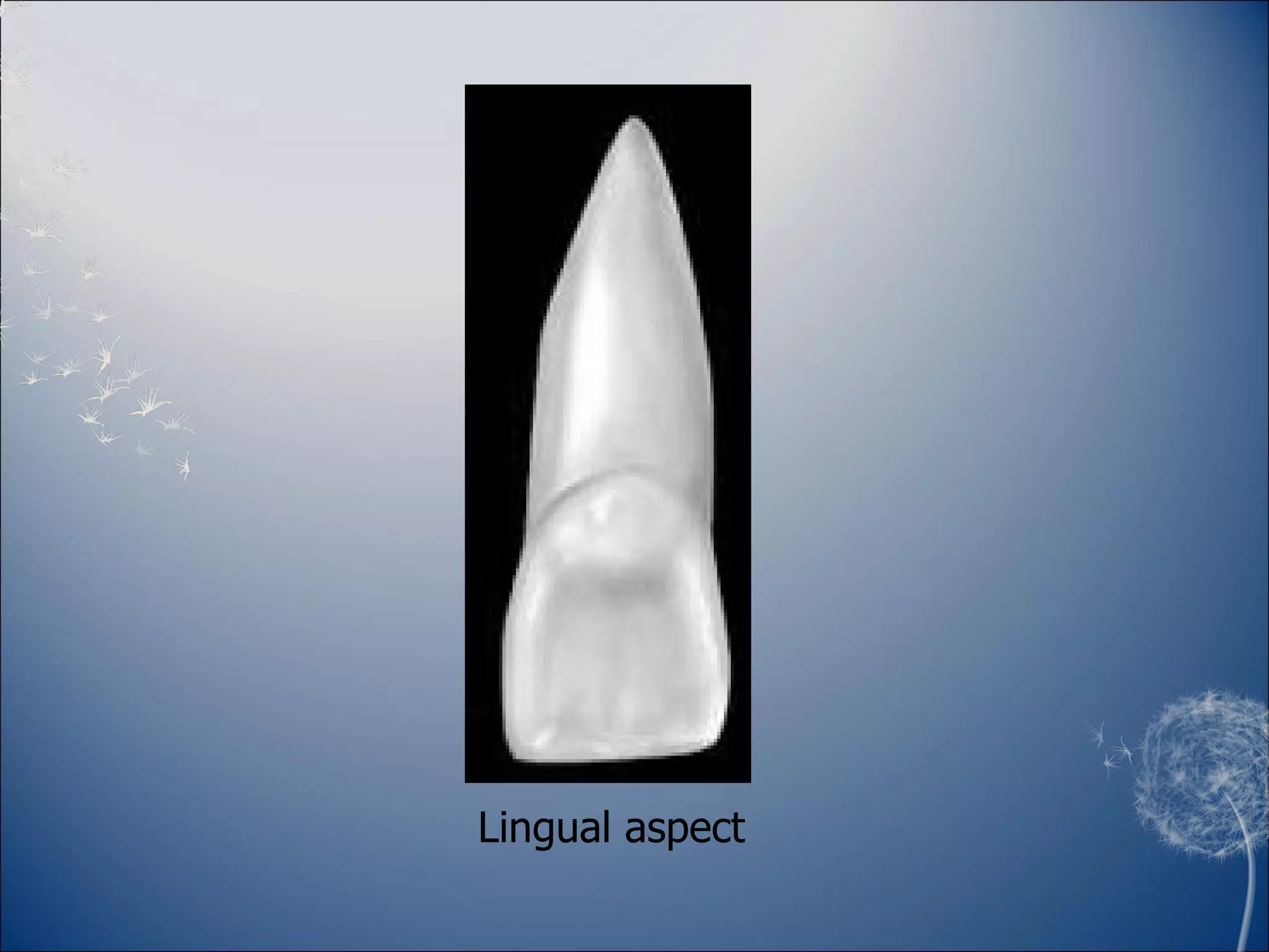 Maxillary Incisors | PPT