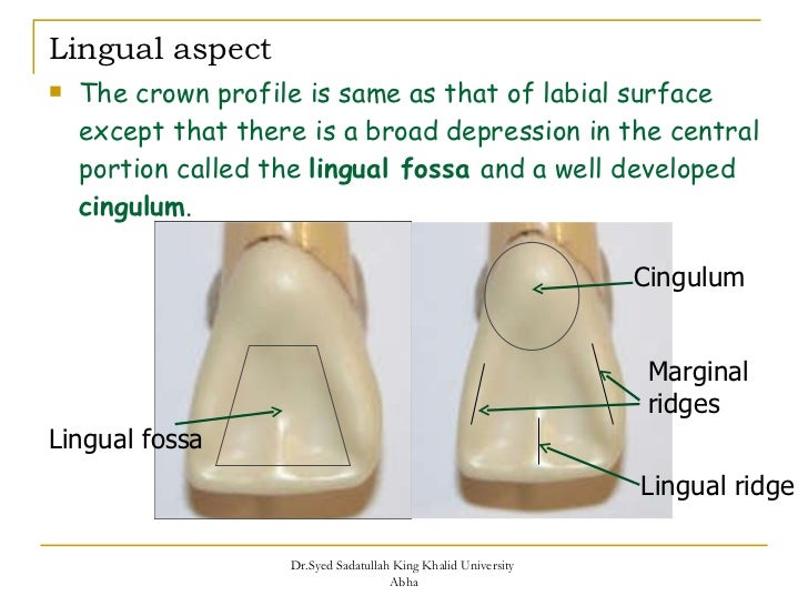 Maxillary Incisors