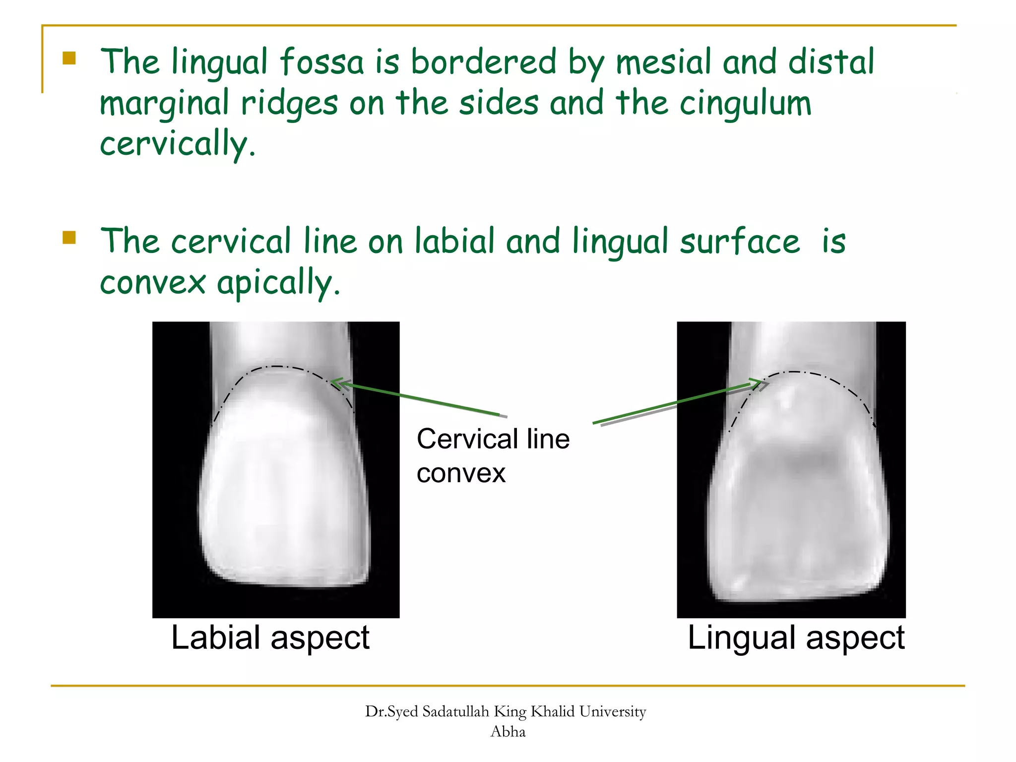 morphology of Maxillary central and lateral incisors teeth | PPT