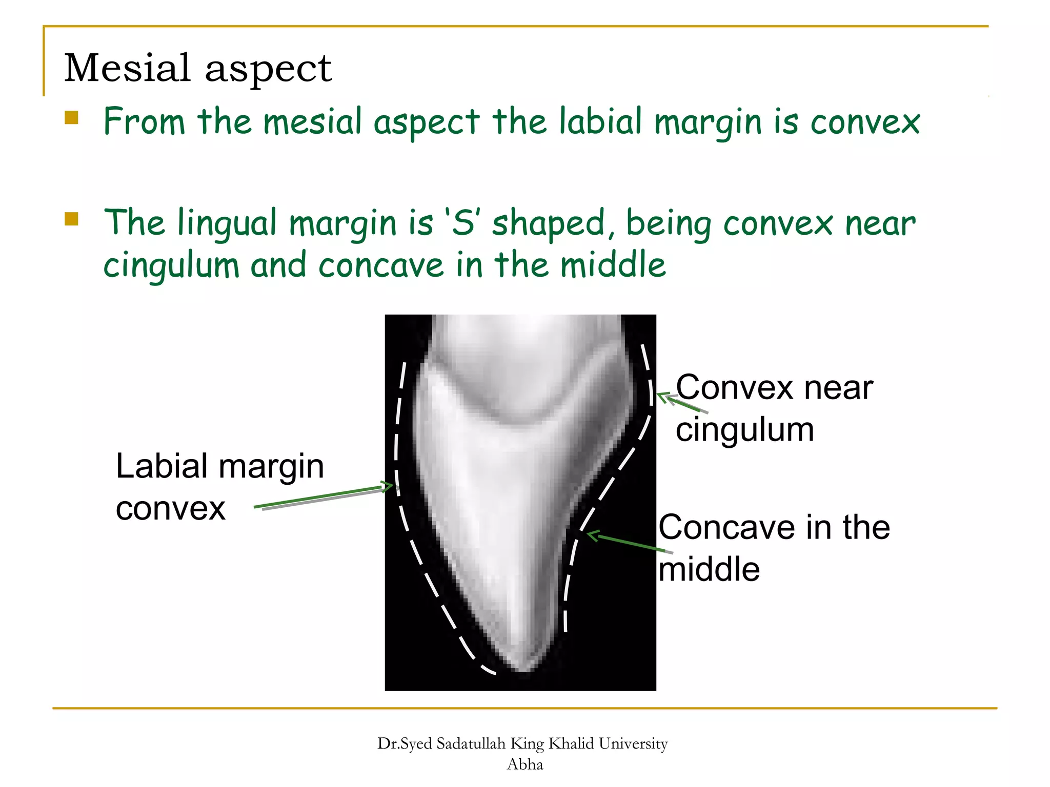 morphology of Maxillary central and lateral incisors teeth | PPT