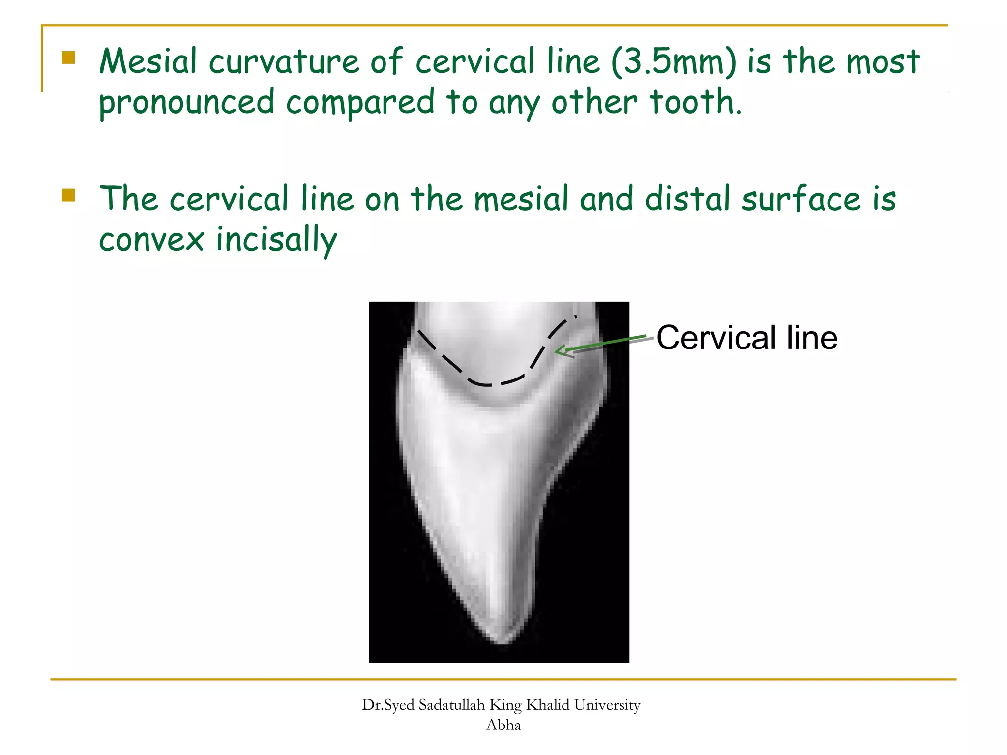 morphology of Maxillary central and lateral incisors teeth | PPT