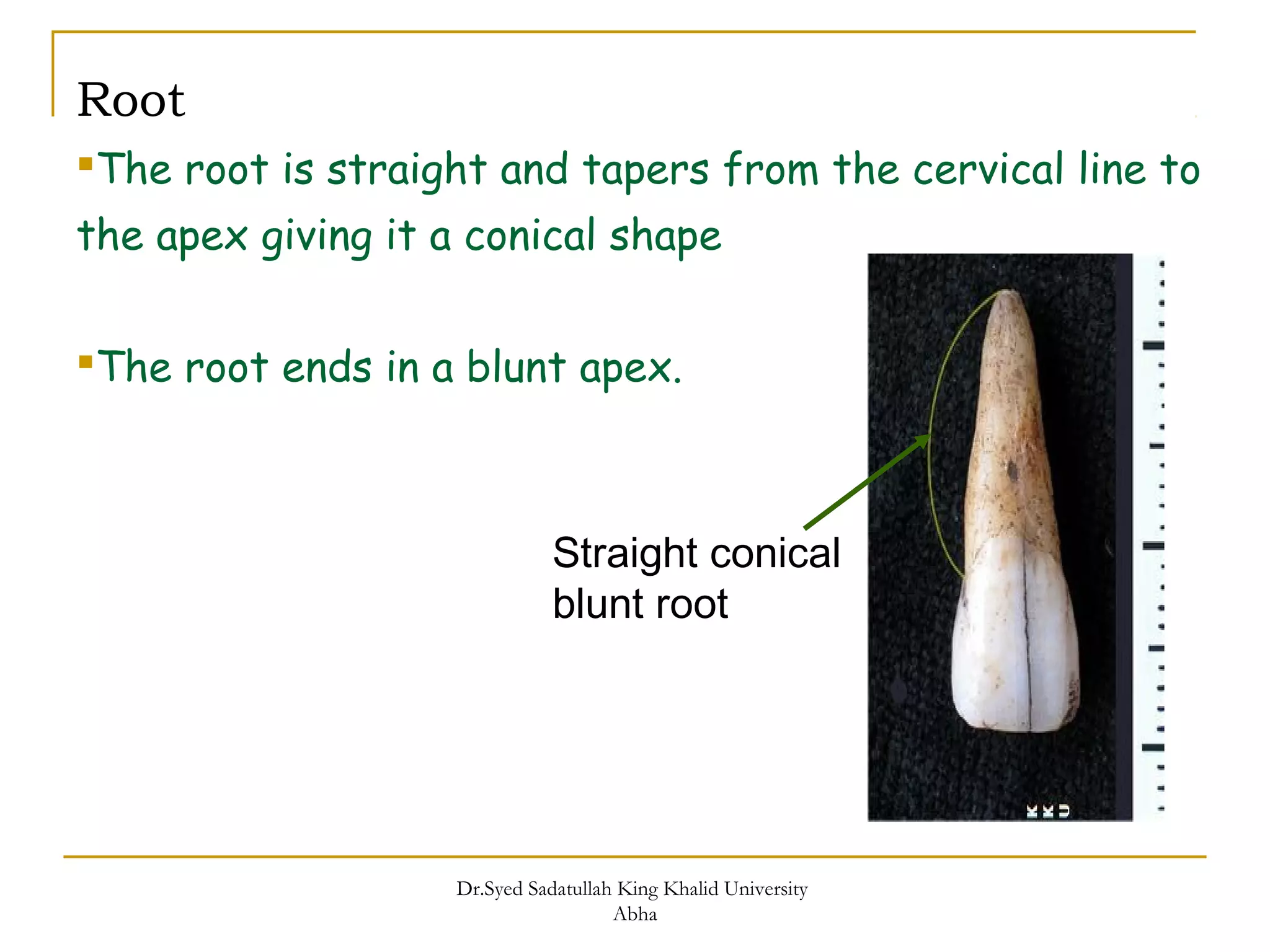 morphology of Maxillary central and lateral incisors teeth | PPT