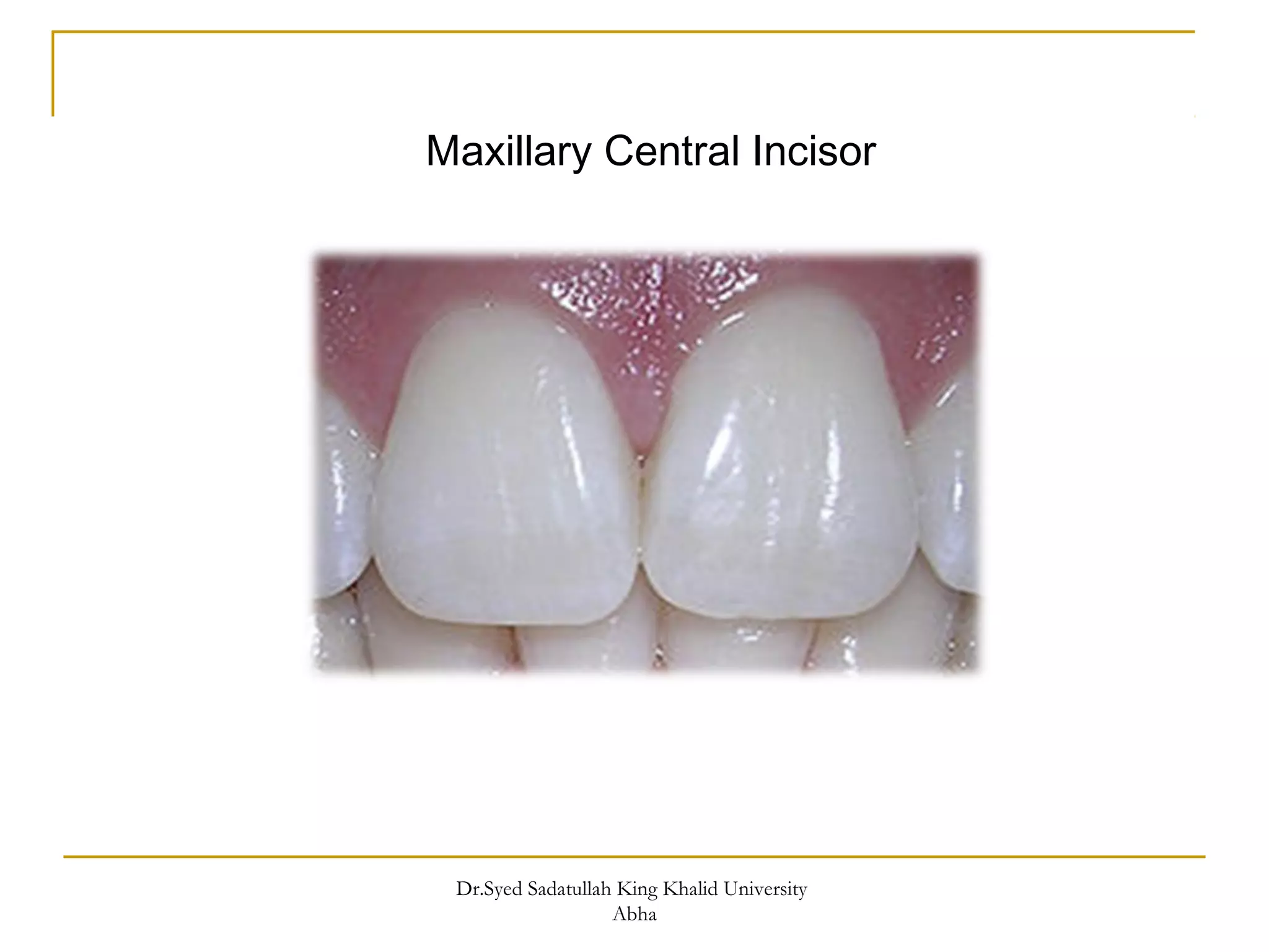 morphology of Maxillary central and lateral incisors teeth | PPT