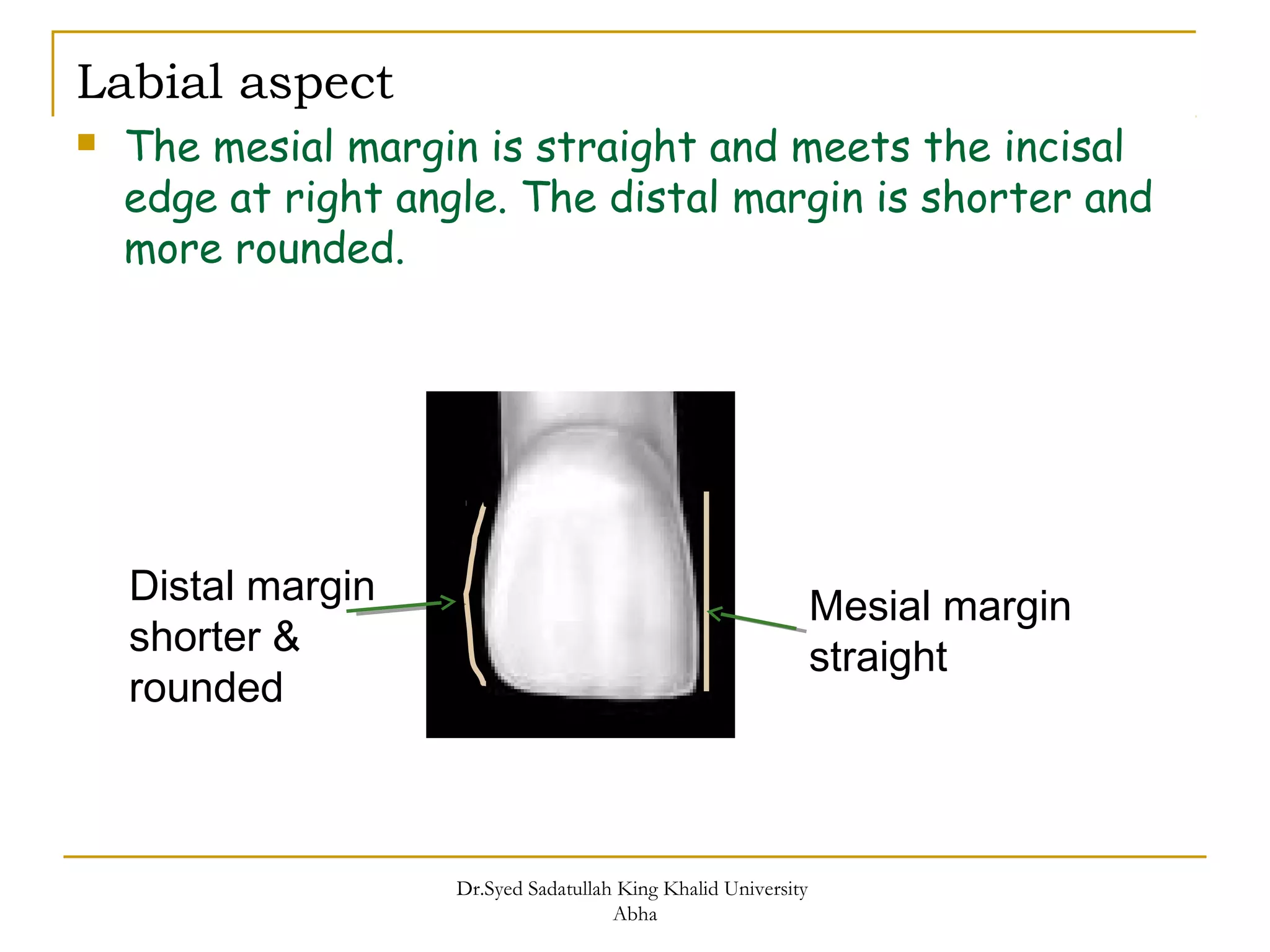 morphology of Maxillary central and lateral incisors teeth | PPT
