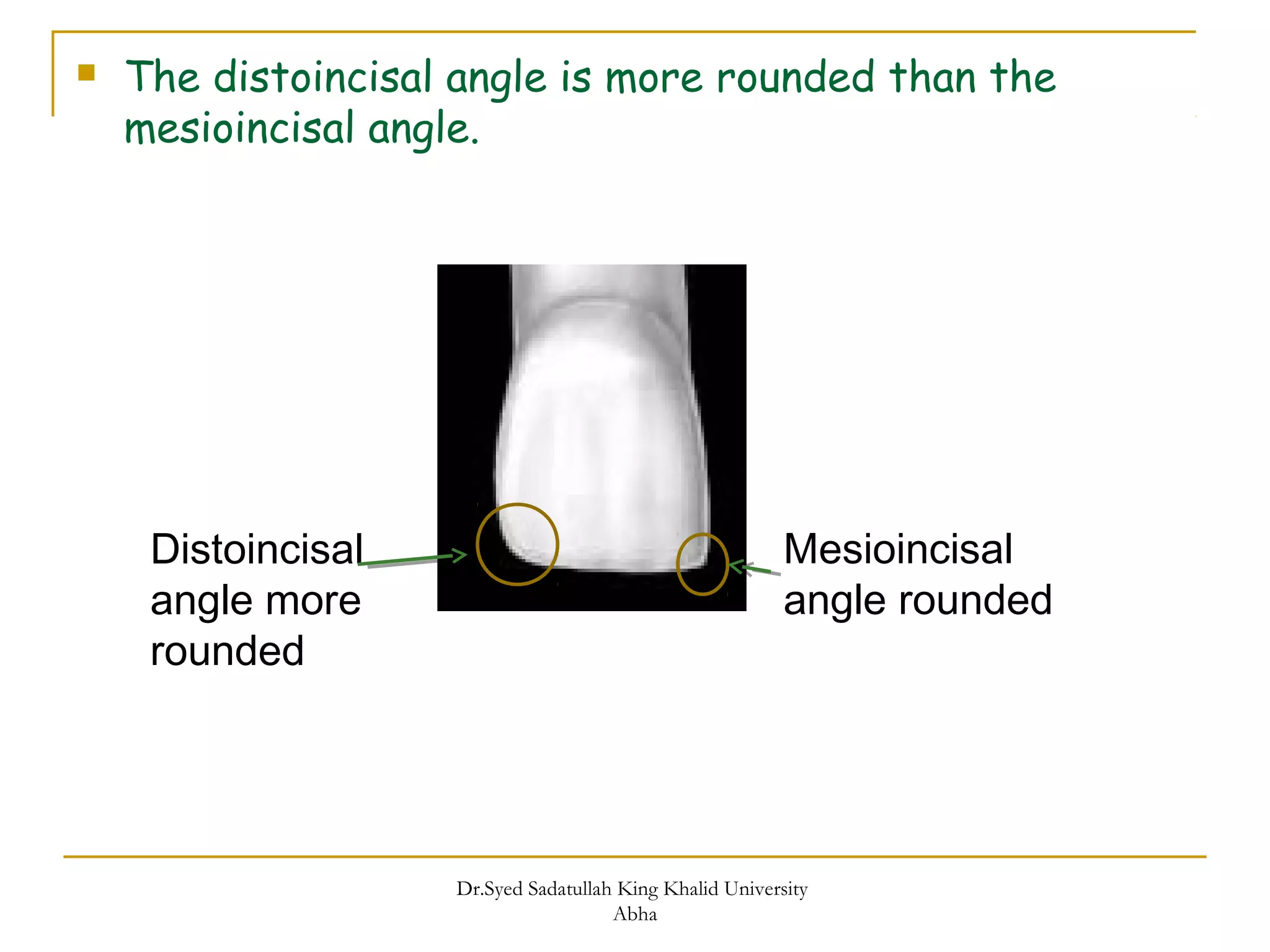 morphology of Maxillary central and lateral incisors teeth | PPT