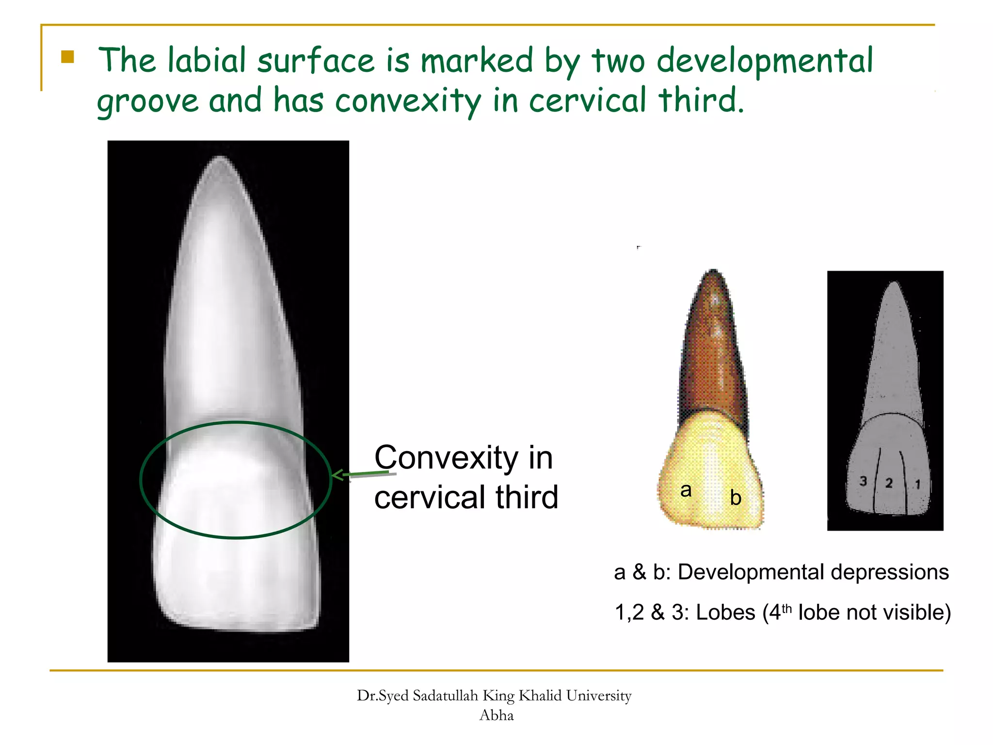 morphology of Maxillary central and lateral incisors teeth | PPT