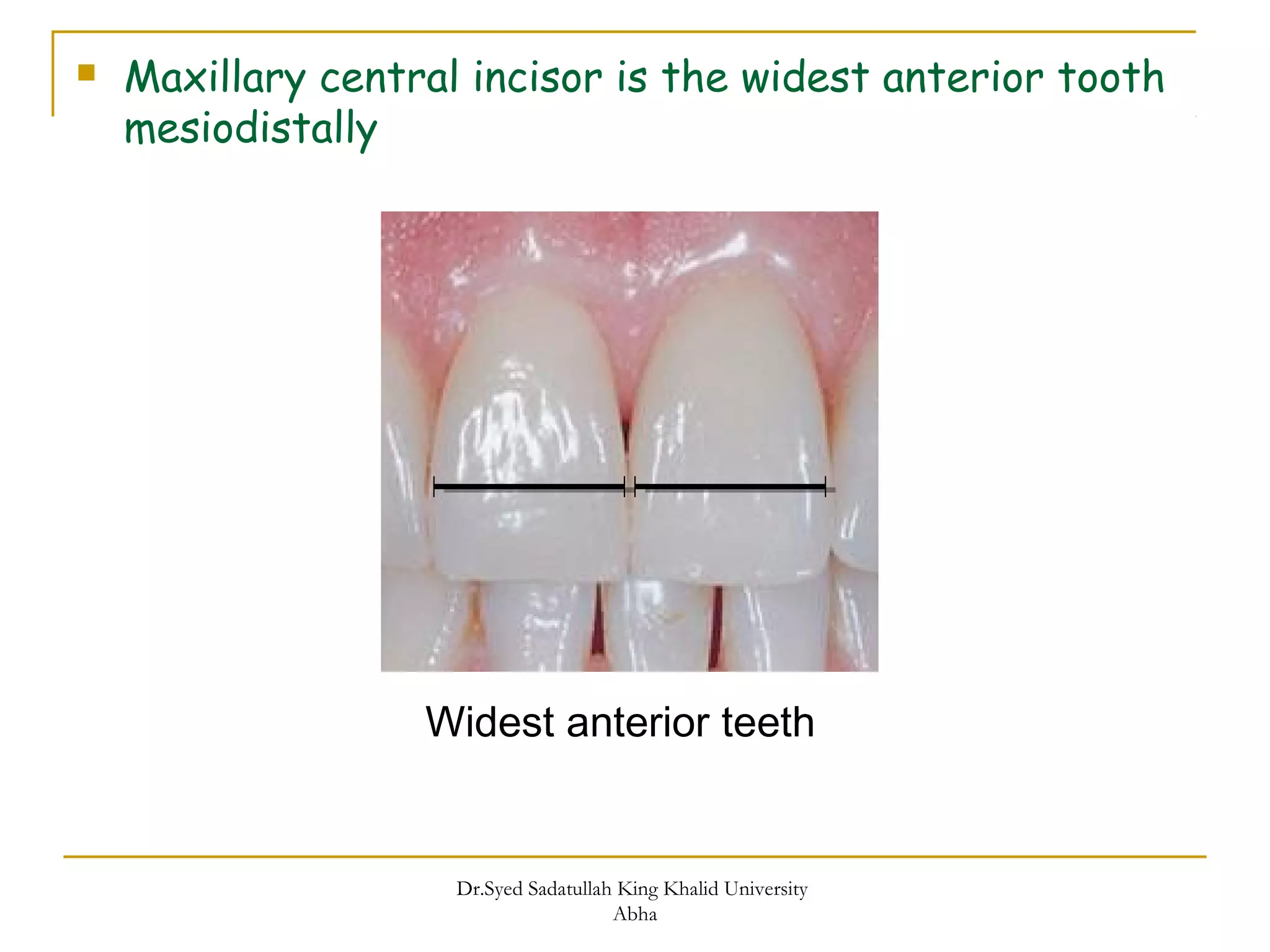 morphology of Maxillary central and lateral incisors teeth | PPT