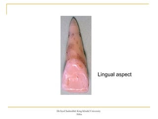 morphology of Maxillary central and lateral incisors teeth | PPT