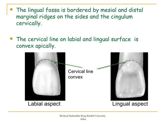 morphology of Maxillary central and lateral incisors teeth | PPT | Dental Health | Diseases and ...