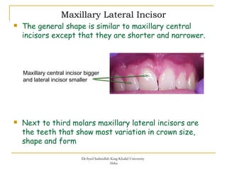 morphology of Maxillary central and lateral incisors teeth | PPT