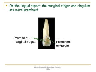 morphology of Maxillary central and lateral incisors teeth | PPT