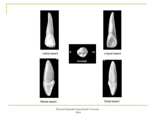 morphology of Maxillary central and lateral incisors teeth | PPT