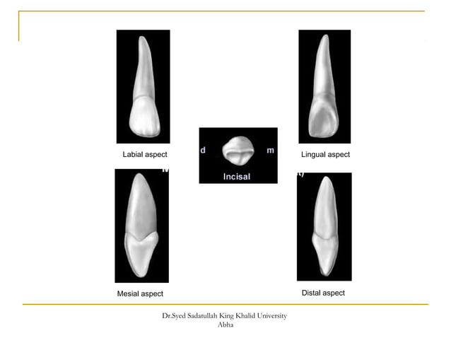 morphology of Maxillary central and lateral incisors teeth | PPT ...
