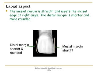 morphology of Maxillary central and lateral incisors teeth | PPT