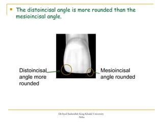 morphology of Maxillary central and lateral incisors teeth | PPT