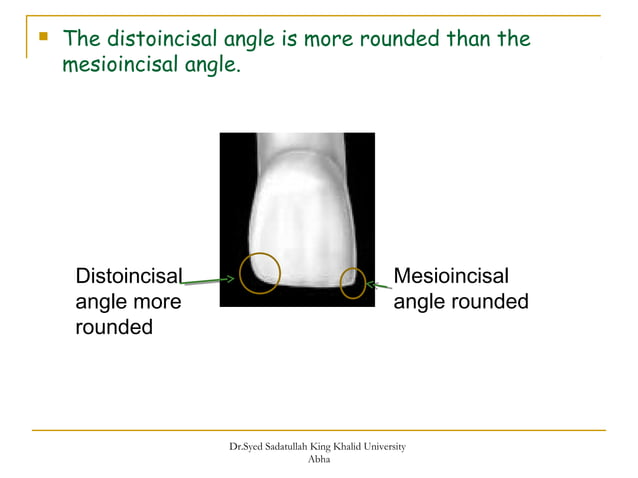 morphology of Maxillary central and lateral incisors teeth | PPT ...