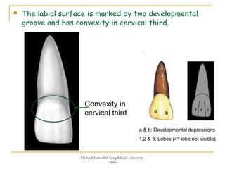 morphology of Maxillary central and lateral incisors teeth | PPT