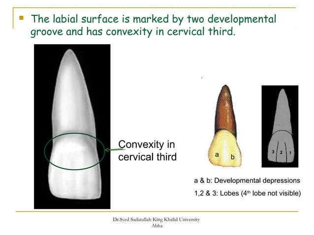 Morphology Of Maxillary Central And Lateral Incisors Teeth Ppt