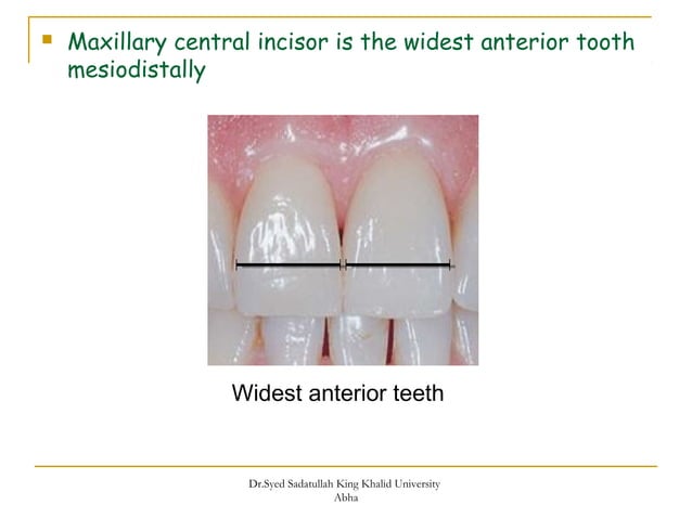 morphology of Maxillary central and lateral incisors teeth | PPT ...