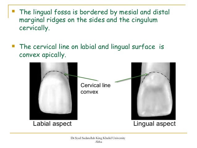 morphology of Maxillary central and lateral incisors teeth
