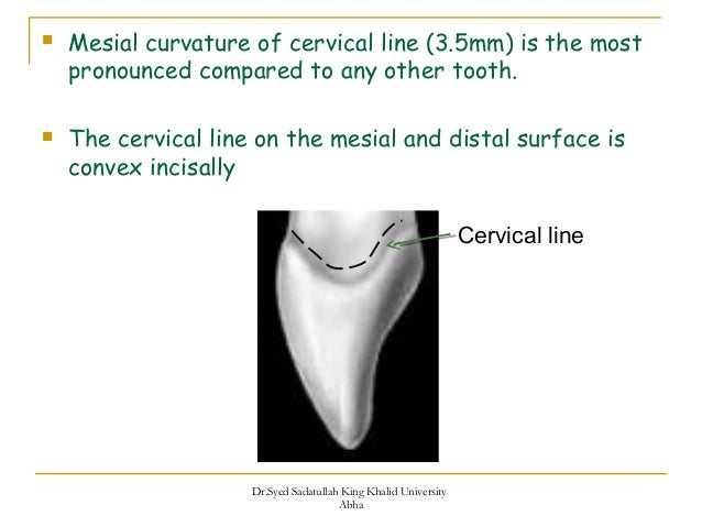 morphology of Maxillary central and lateral incisors teeth