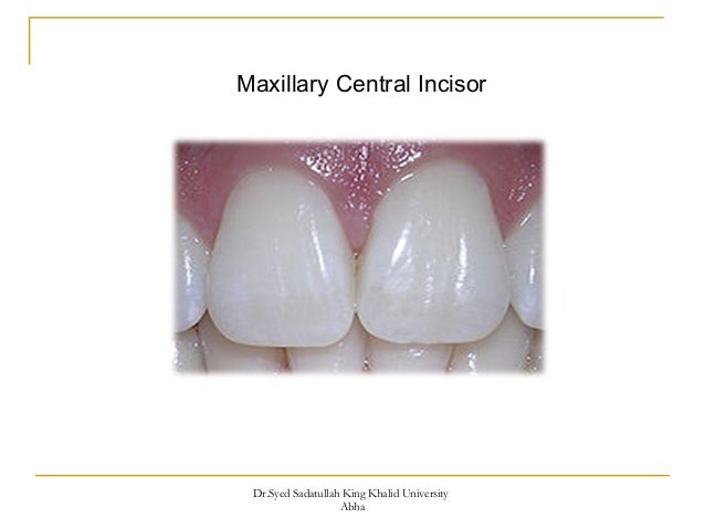 morphology of Maxillary central and lateral incisors teeth