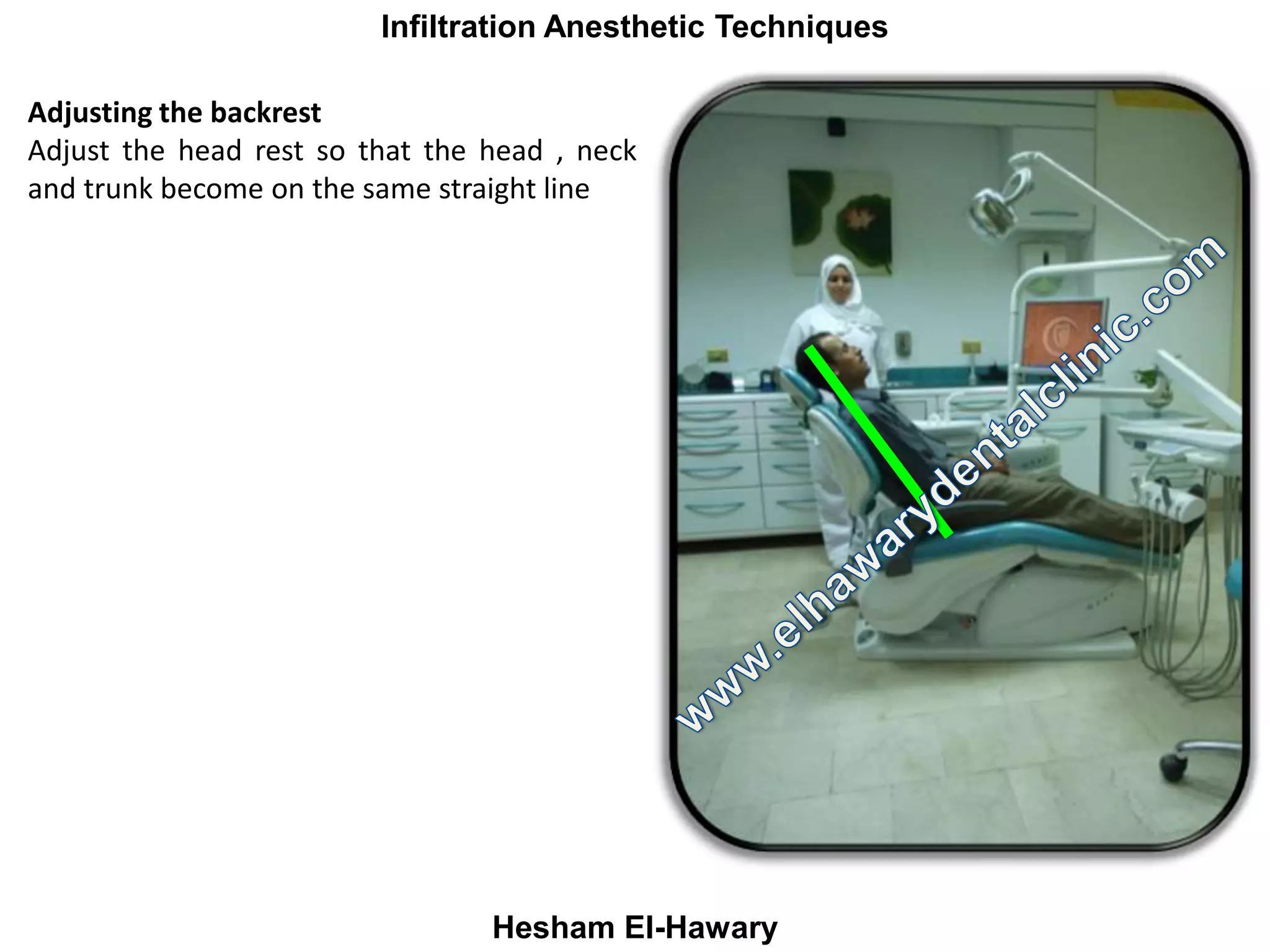 Maxillary infiltration anesthetic techniques (with photos) | PPTX ...