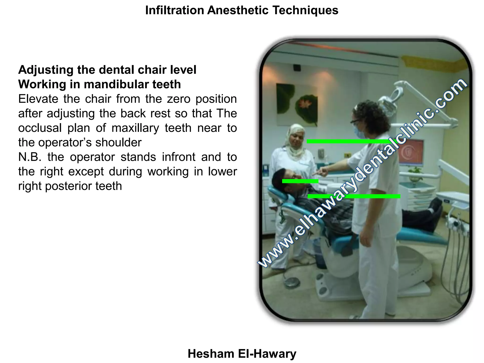 Maxillary infiltration anesthetic techniques (with photos) | PPTX ...