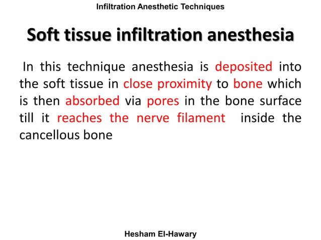 Maxillary infiltration anesthetic techniques (with photos) | PPTX ...