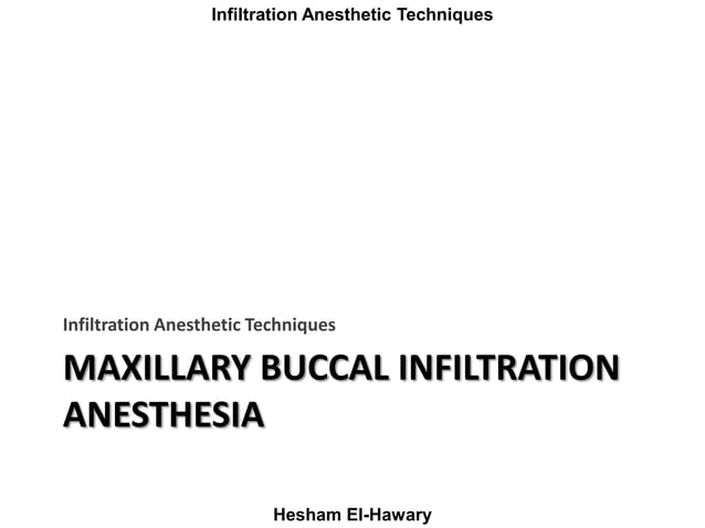 Maxillary infiltration anesthetic techniques (with photos) | PPTX ...