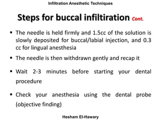 Maxillary infiltration anesthetic techniques (with photos) | PPTX