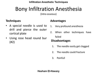 Maxillary infiltration anesthetic techniques (with photos) | PPTX