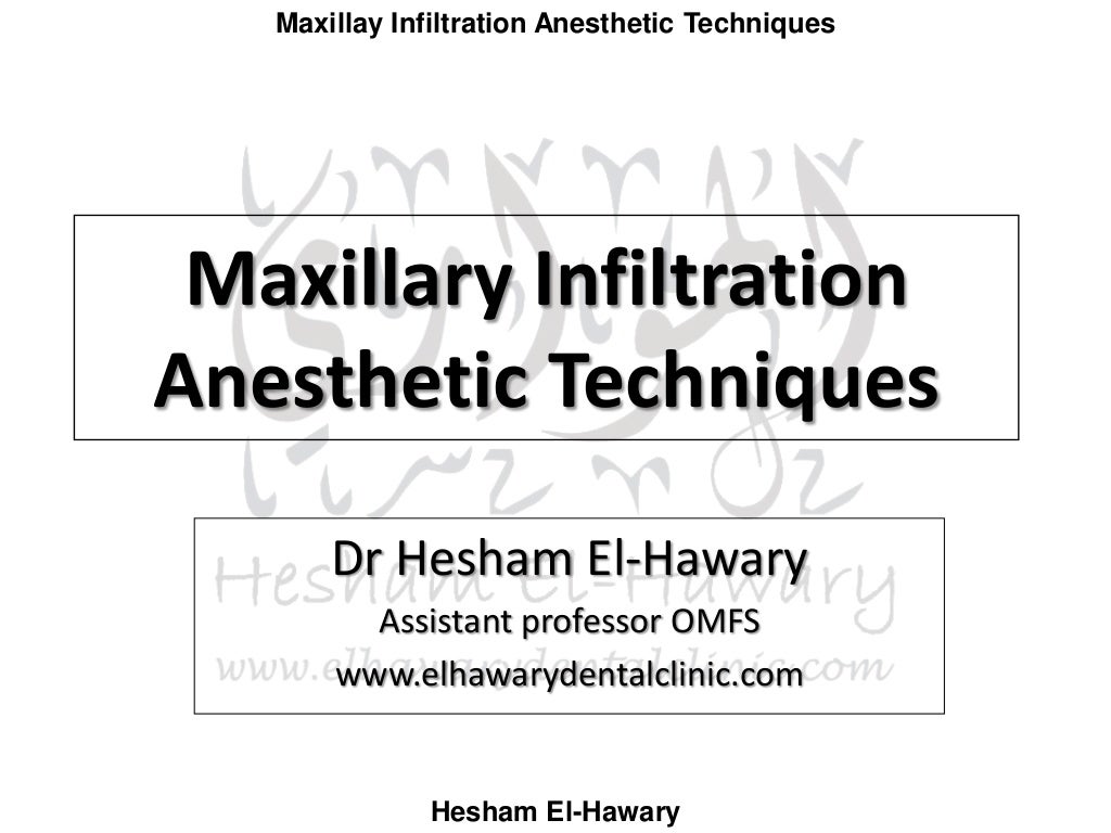 Maxillary infiltration anesthetic techniques (with photos)