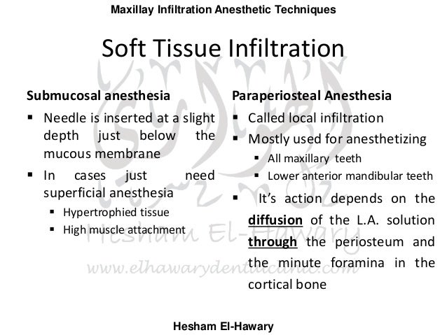 Maxillary infiltration anesthetic techniques (with photos)