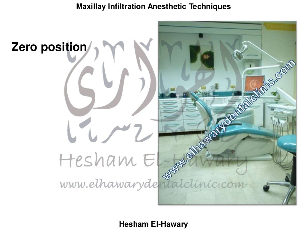 Maxillary infiltration anesthetic techniques (with photos)