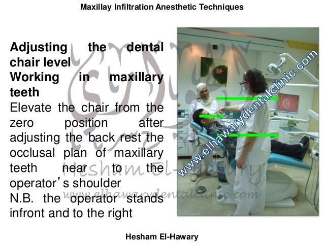 Maxillary infiltration anesthetic techniques (with photos)